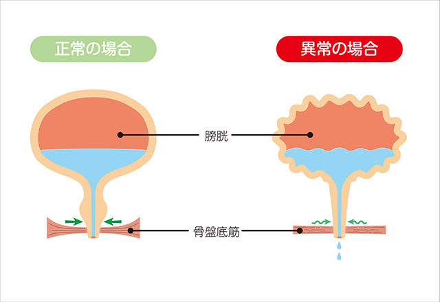 頻尿のお悩み 前立腺肥大、過活動膀胱を漢方で改善 | 漢方薬の健康堂薬局